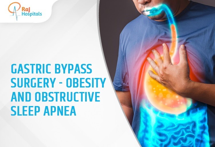 Gastric Bypass Surgery - Obesity and Obstructive Sleep Apnea